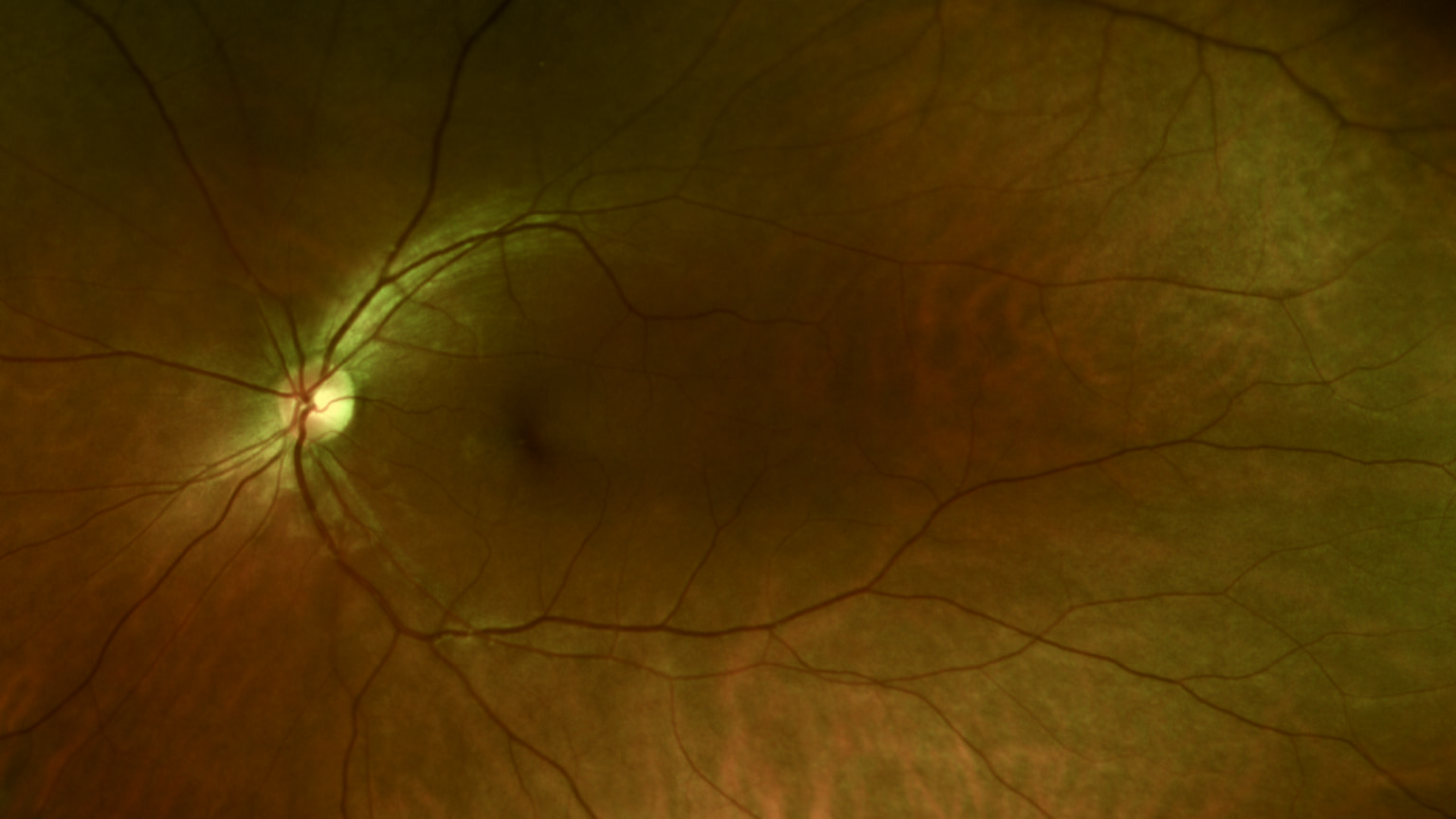 O QUE É RETINA? - Dra. Ana Suzuki